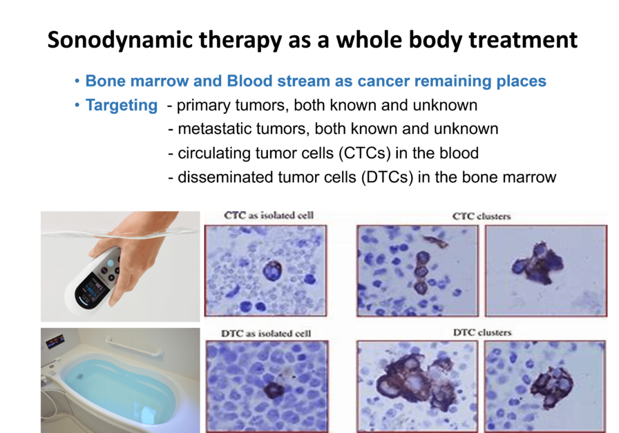 Photodynamic Sonodynamic Therapy (PDT/SDT) | Saisei Immunotherapy Clinics