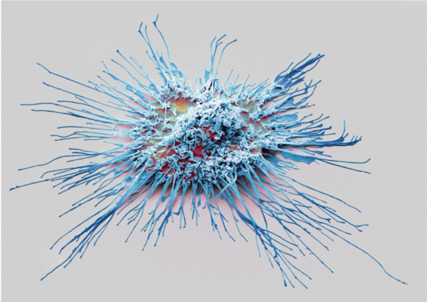 Cancer vaccine therapy | Saisei Immunotherapy Clinics