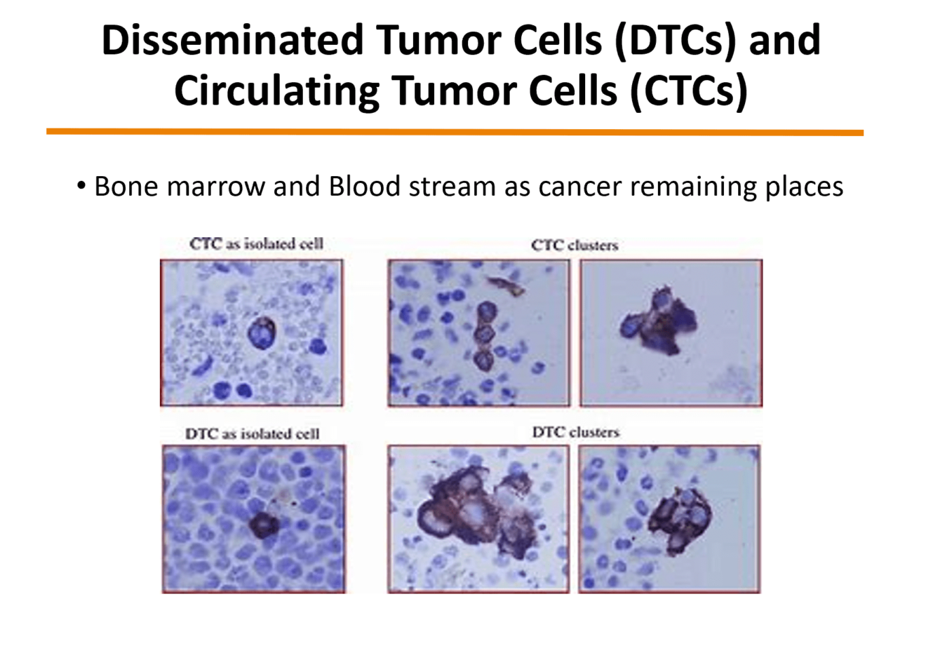 Photodynamic Sonodynamic Therapy (PDT/SDT) | Saisei Immunotherapy Clinics